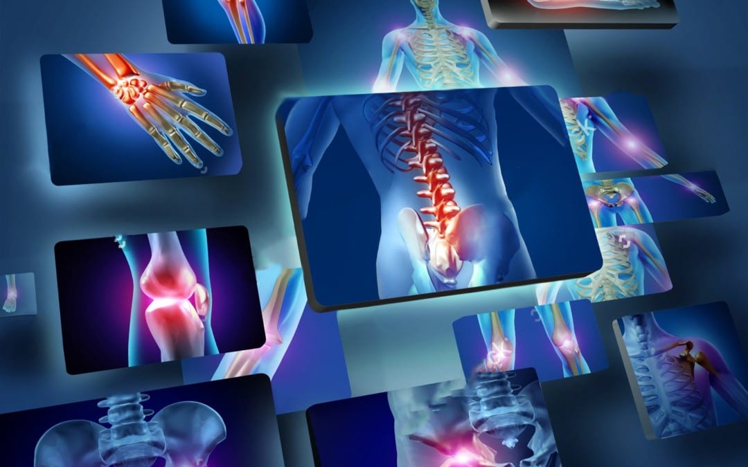 Alleviate Joint Inflammation With Chiropractic Therapy - El Paso Back ...