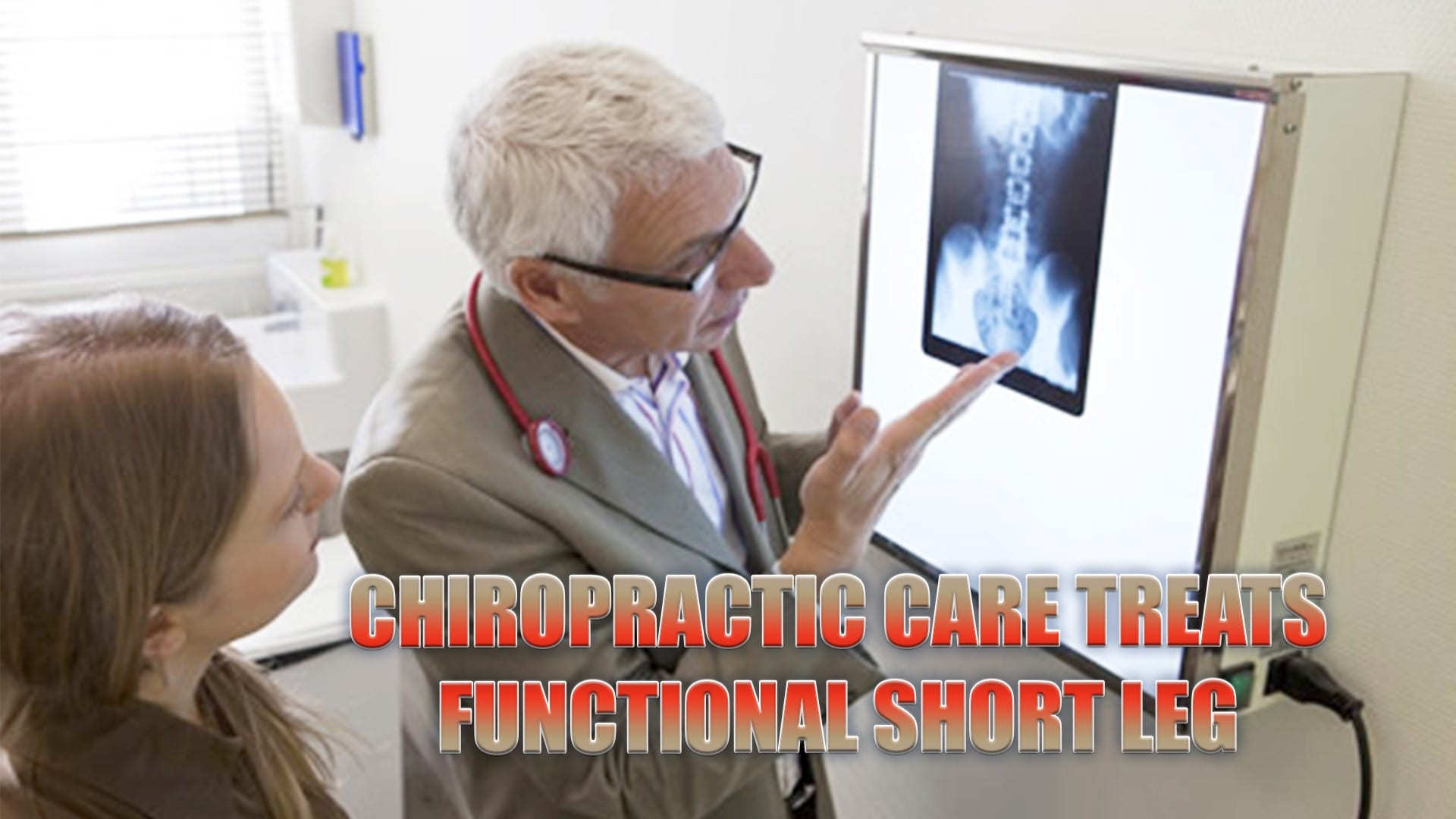 What Is Functional Short Leg Syndrome at Charli Fiaschi blog
