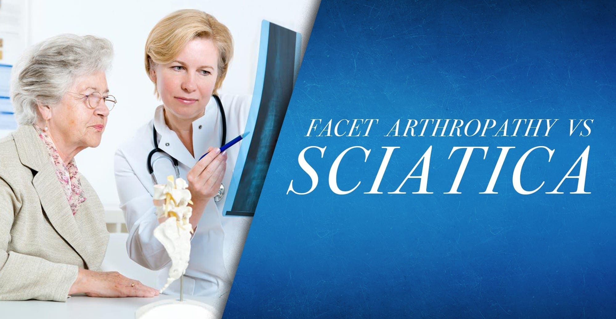 Facet Arthropathy vs Sciatica - El Paso Back Clinic® • 915-850-0900