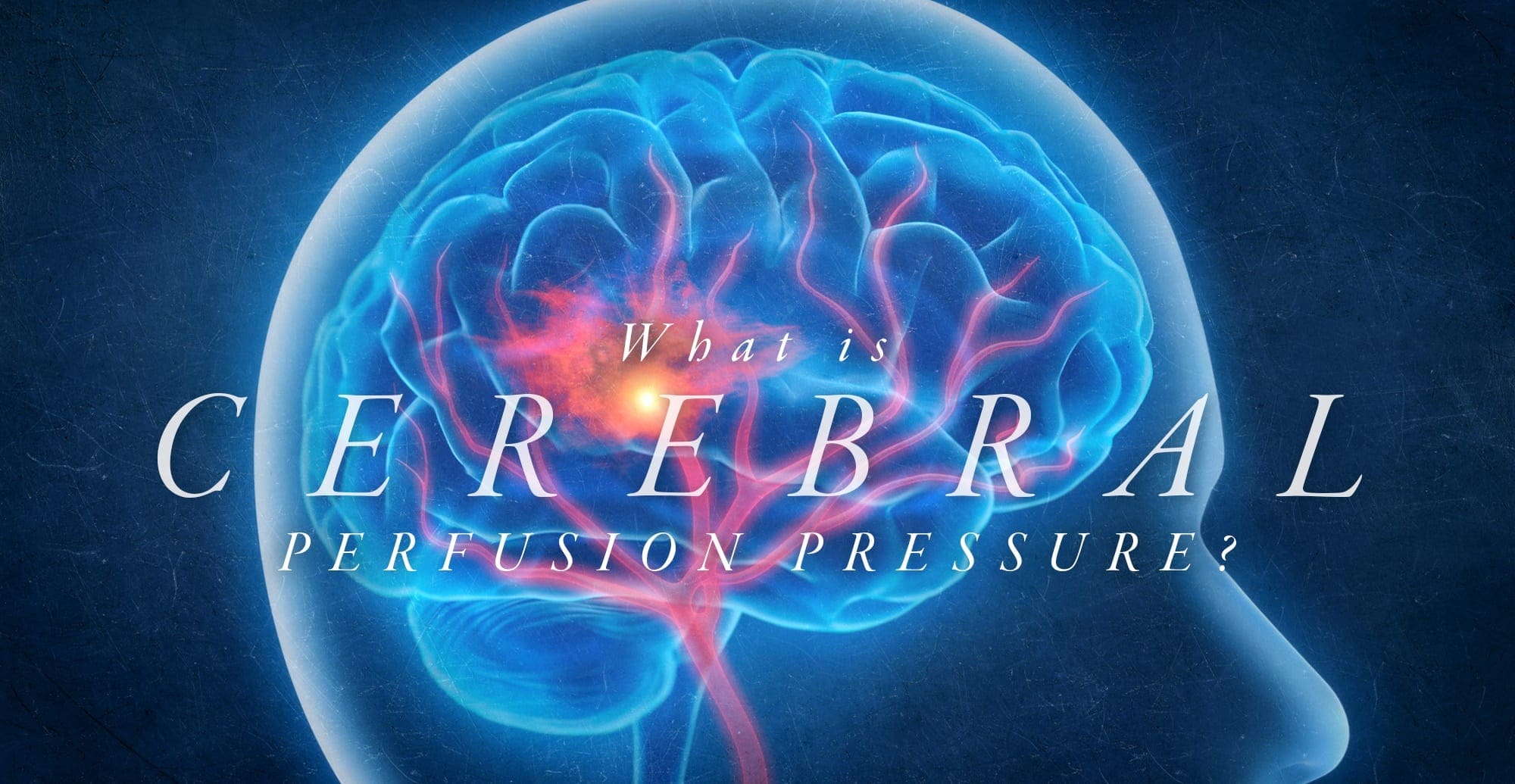 ¿Qué es la presión de perfusión cerebral? - El Paso Back Clinic® • 915-850-0900